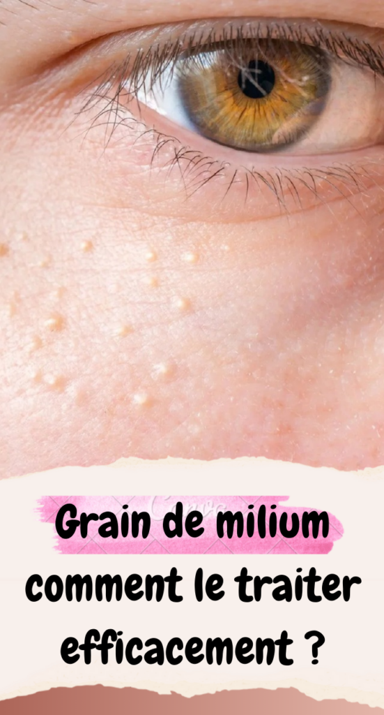 Grain de milium : comment le traiter efficacement