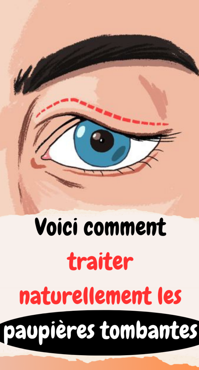 Voici comment traiter naturellement les paupières tombantes